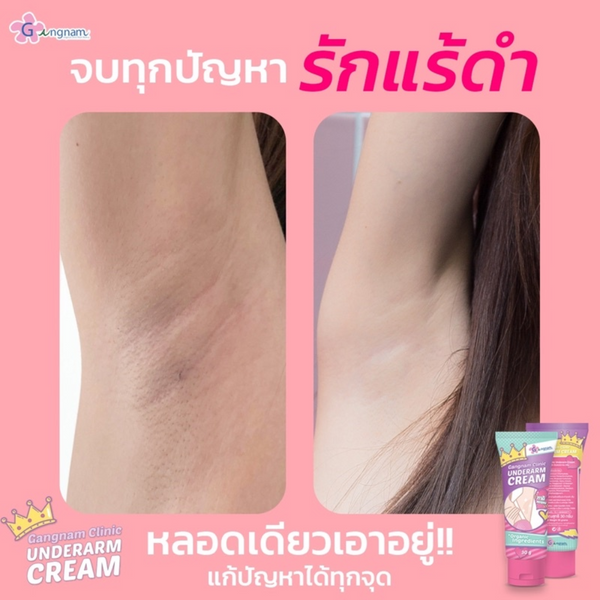 Gangnam Clinic Underarm Cream - ThaiGlowStore
